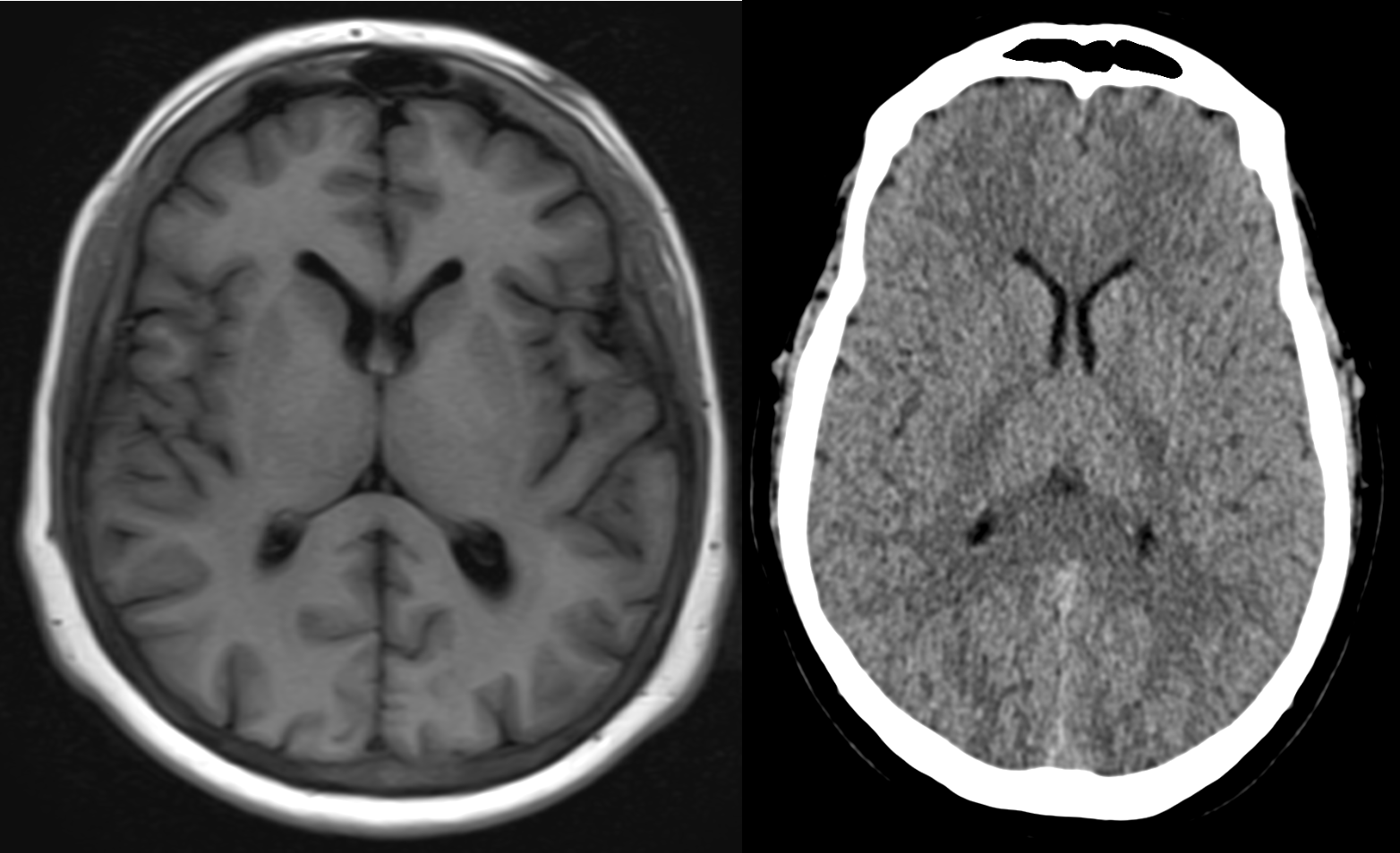 Mediphany How To Read An MRI Or CT Scan